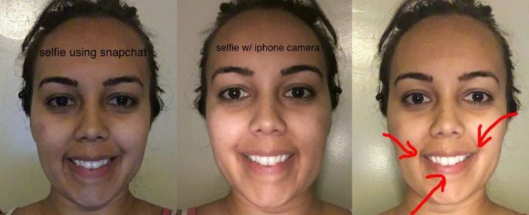 How can I fix my crooked smile/ face? | Cosmetic Dentist Los Angeles ...